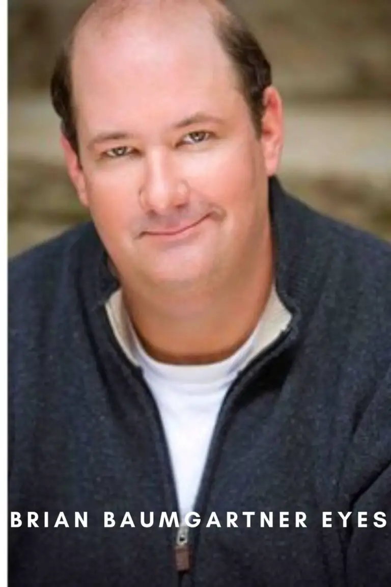 What happened to Brian Baumgartner eyes