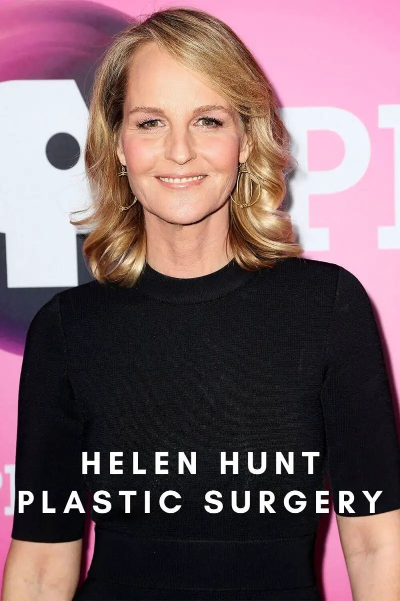 Has Helen Hunt Plastic Surgery?