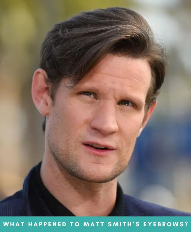 What Happened To Matt Smith Eyebrows